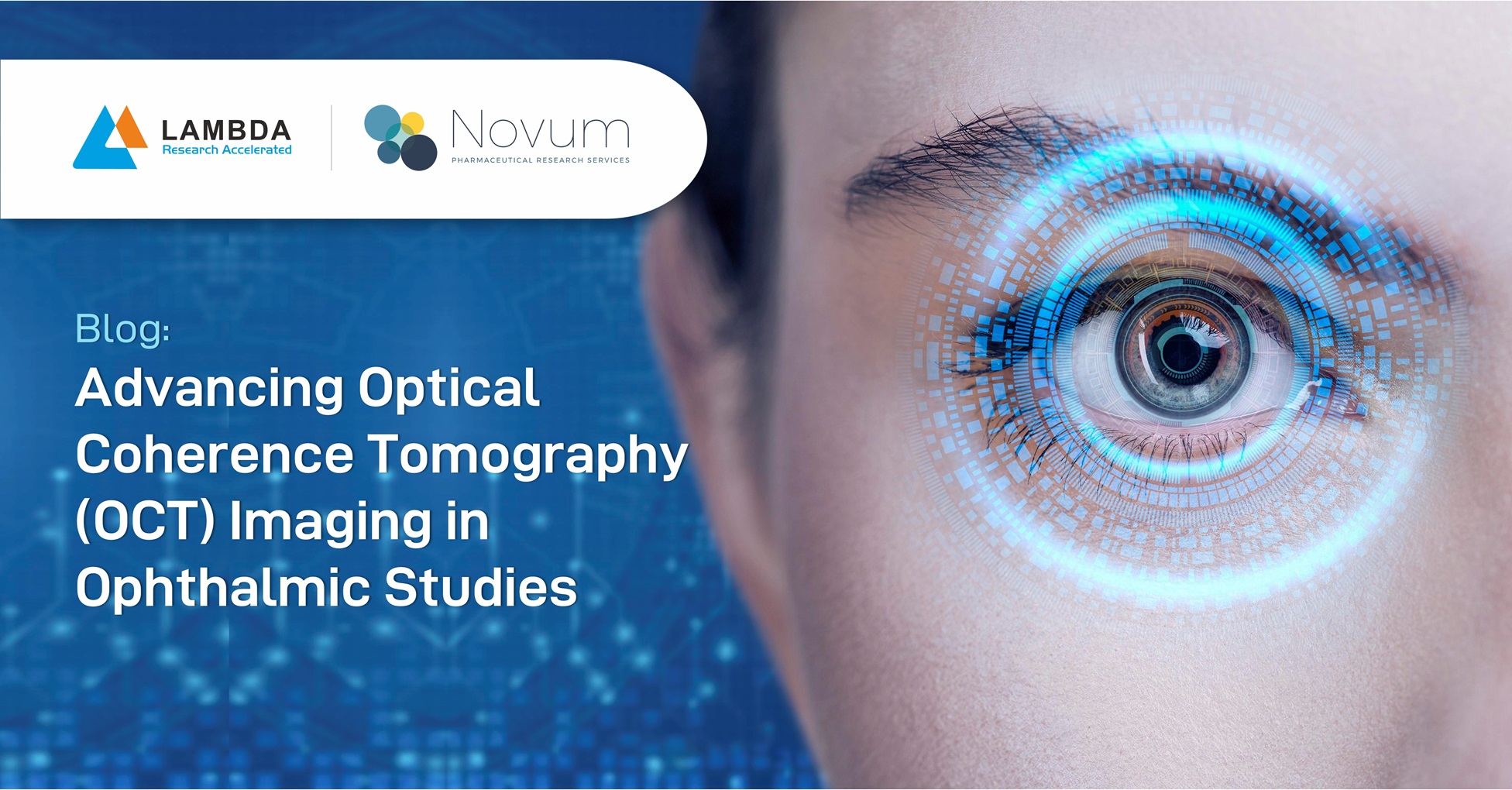 Advancing OCT imaging in Ophthalmic Studies | Lambda CRO